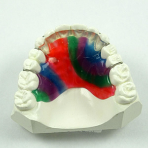 Types Of Appliances | Milberg Orthodontics